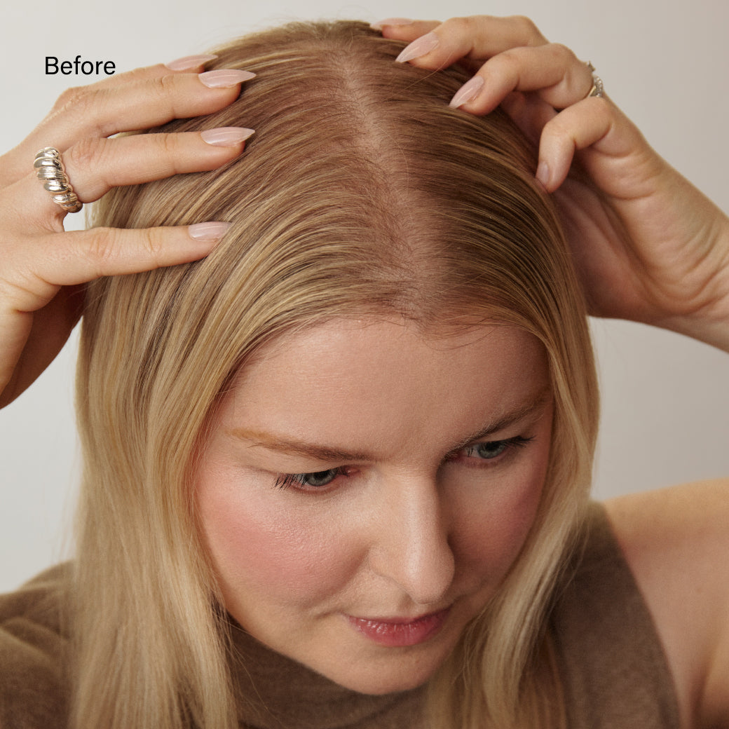 Scalp Hair Fill-Ins - Luxy® Hair